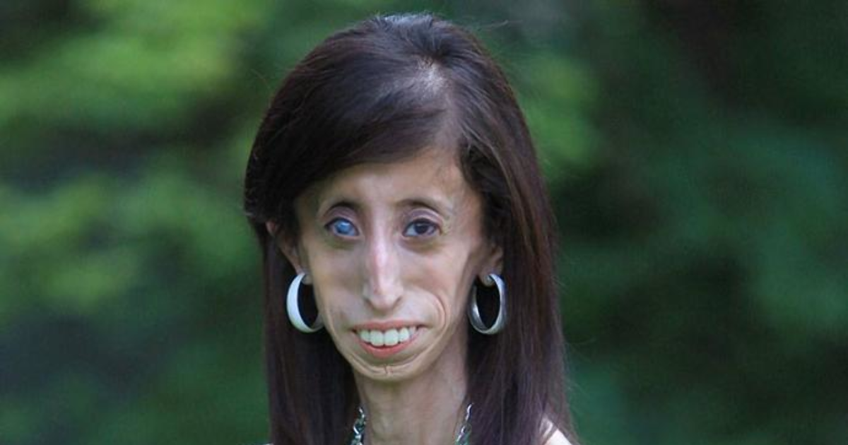 Hasta İnsanlar Çirkin Değildir