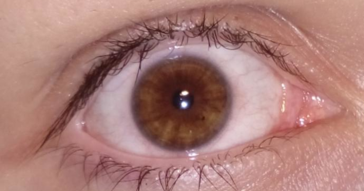 Göz rengi bal rengi mi ela mi kehribar mi arkadaslar? - KizlarSoruyor