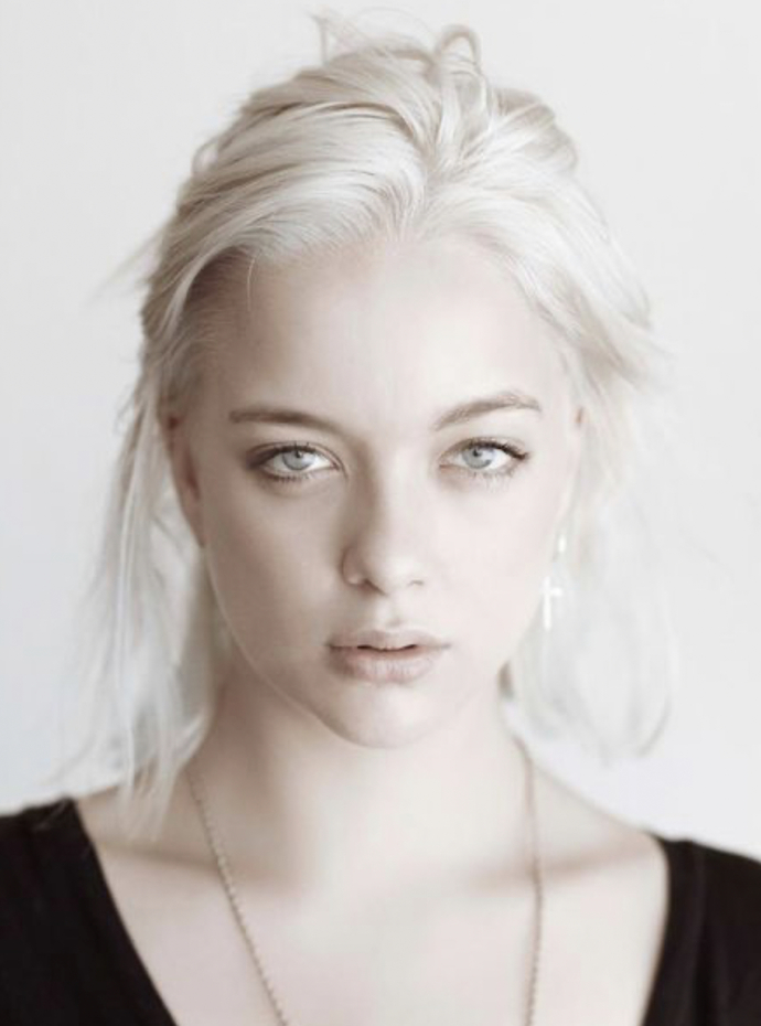 Aşırı beyaz ten rengine sahip olmak sorun mu? - KizlarSoruyor