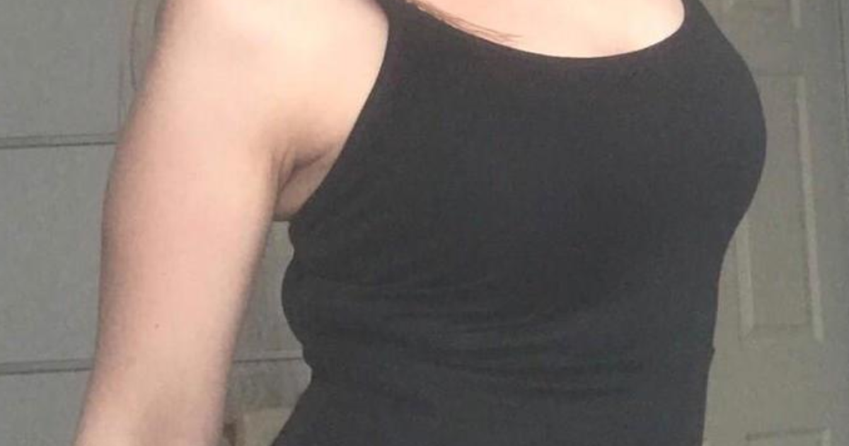 1.62 boyunda 52 kilo biri neden bu kadar şişman gösterir? - KizlarSoruyor