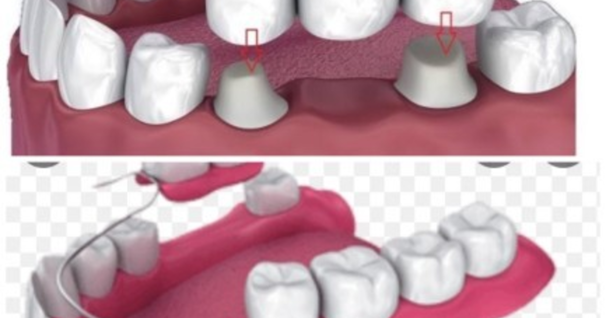 Devlet hastanesinde diş tedavisi? - KizlarSoruyor