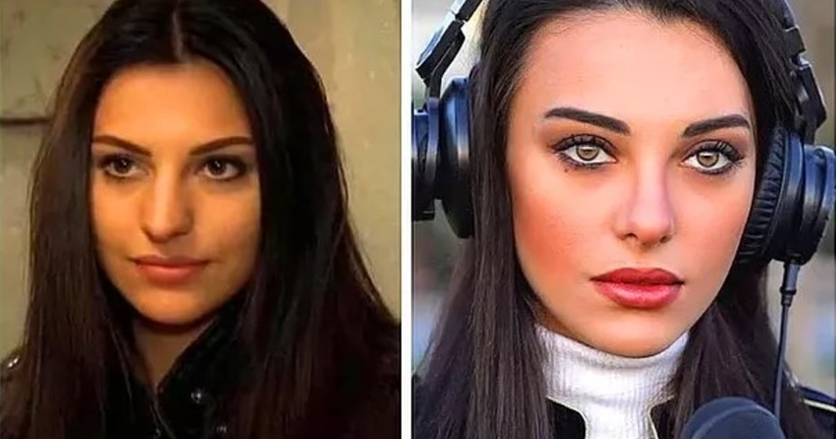 Burnum büyük diye bana laz mısın diye soruyorlar. Estetik mi olmak ...