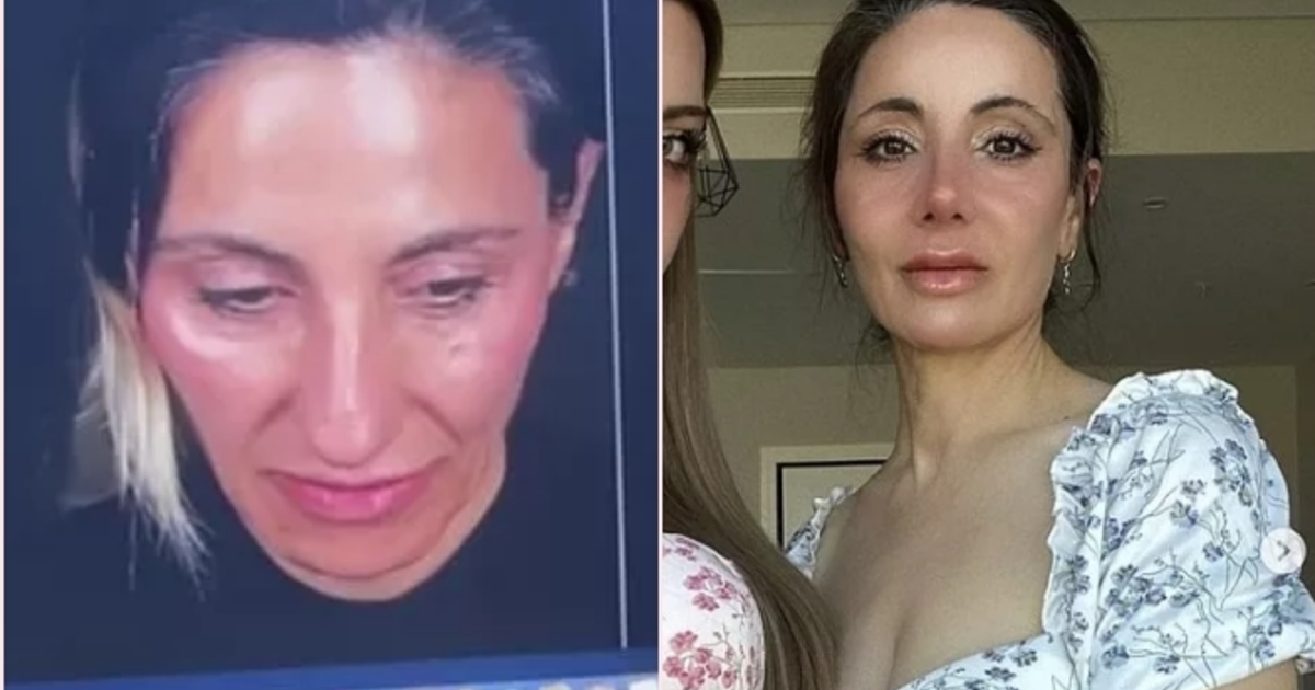 Mika Raun annesinin estetikle değişimini paylaştı! Sizce nasıl olmuş ...