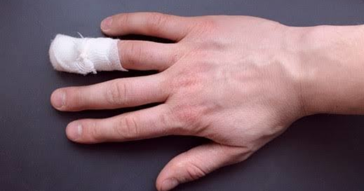 Eklem yerindeki yaralanmaların iyileşme sürecini hızlandırmak için ne ...