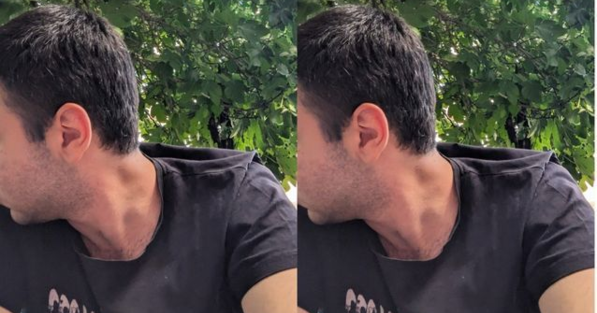 Ten rengim buğday mı? - KizlarSoruyor