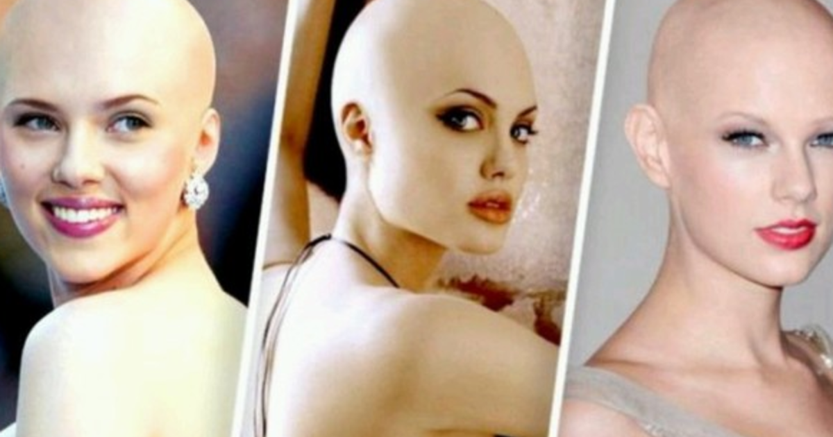 Kadınlara kel olmak bile yakışır mı? - KizlarSoruyor