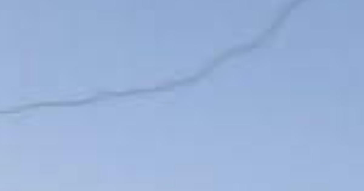 Arkadaşlar parlak bir zemine ya da gökyüzüne bakıp gözlerinizi hareket ...