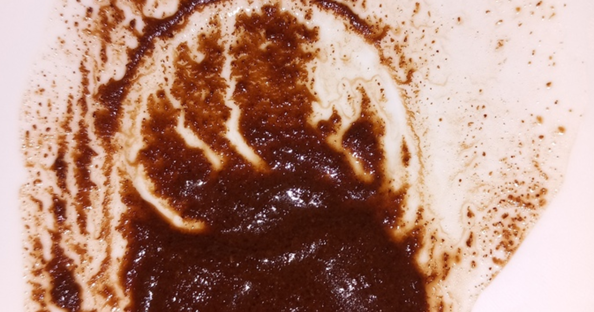 Falima bakacak birileri var mi nolur? - KizlarSoruyor