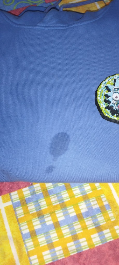 Bu leke nasıl geçer? - KizlarSoruyor