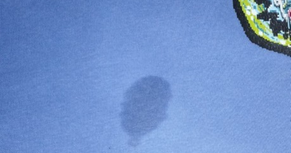 Bu leke nasıl geçer? - KizlarSoruyor