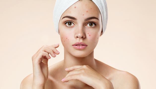 İmex Sivilce Kremi Kullananlar ve Yorumları, İşe Yarıyor mu ...